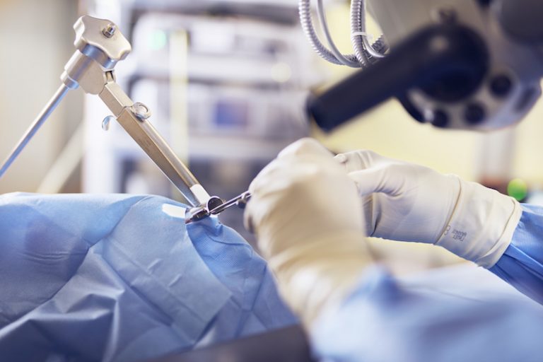 Larynx Surgical Therapy | MEDICAL VOICE CENTER | Highly specialized for ...