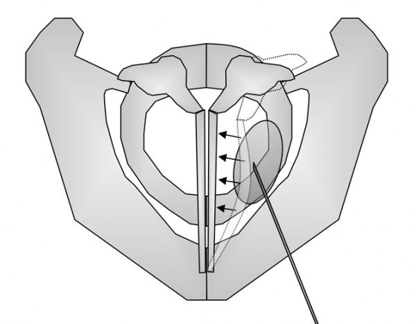 Augmentation | MEDICAL VOICE CENTER | Highly specialized for your voice